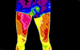Image Study - infrared thermal image review course